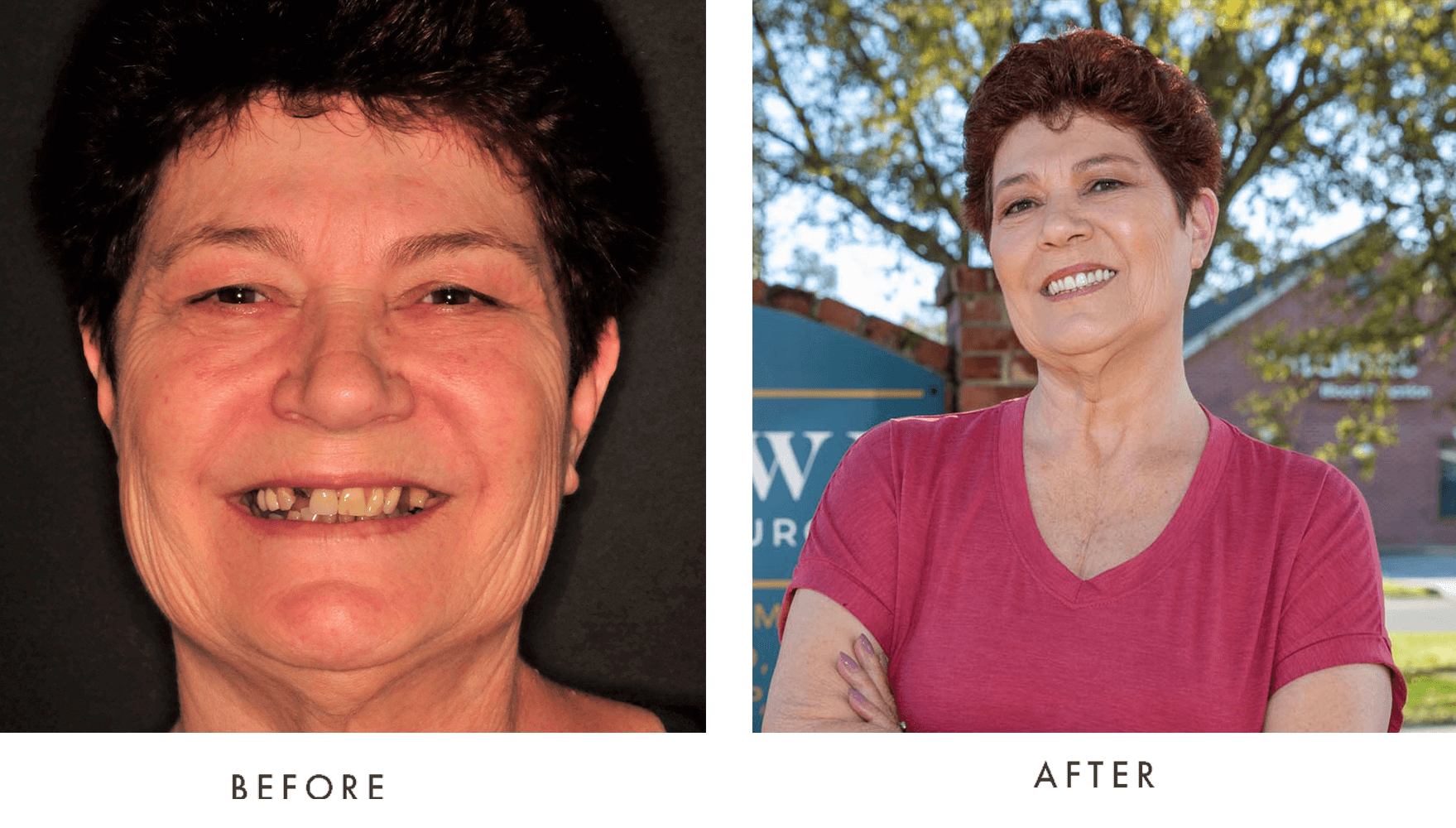Before & After Photos | Midtown Oral & Facial Surgery | Hattiesburg, MS