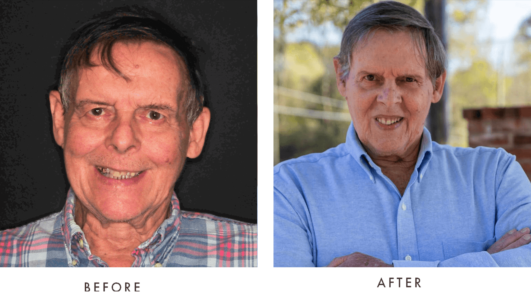 Before & After Photos | Midtown Oral & Facial Surgery | Hattiesburg, MS