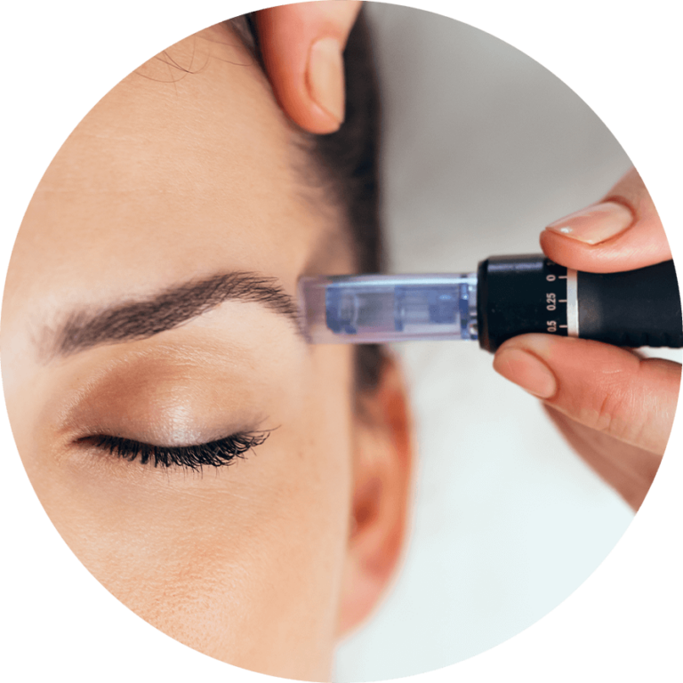 PRP Microneedling | Midtown Oral & Facial Surgery